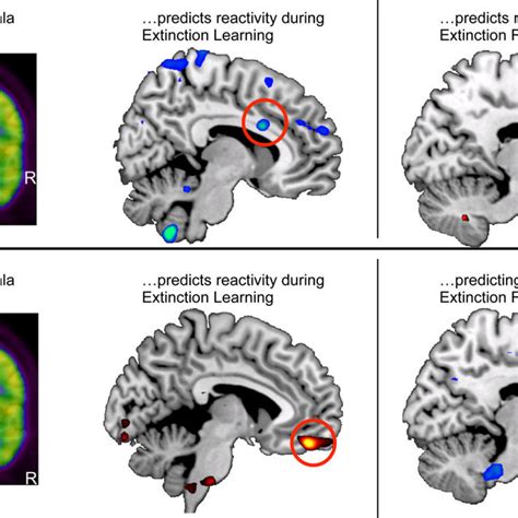 Ventromedial Prefrontal Cortexdorsal Anterior Cingulate Cortex Resting Download Scientific