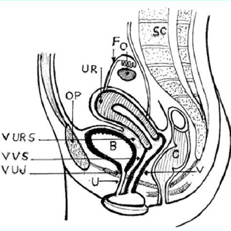 Pdf Survival Up To 515 Years In Young Women Following Genital