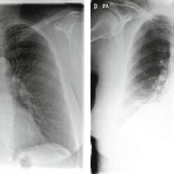 An Image Example From Each Dataset Used In The Experimentation