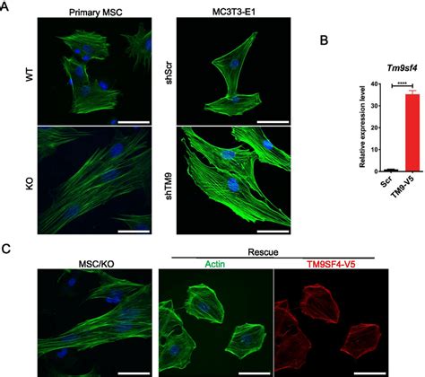 Tm9sf4 Suppression Promotes Actin Filament Polymerization Actin Fibers