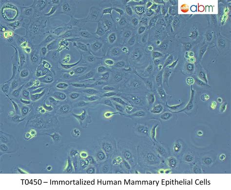 Immortalized Human Mammary Epithelial Cells Applied Biological Materials Inc