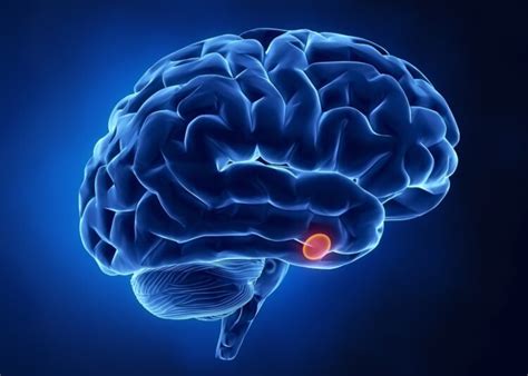 La gestion médicale de l apoplexie hypophysaire donne des résultats