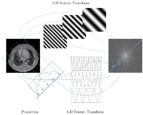 Biomedical Engineering How Is The First Image Estimate Generated In