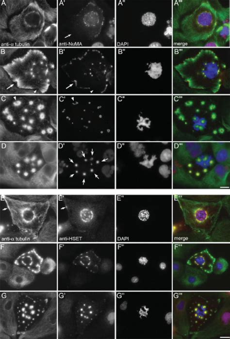 Figure 1 From Live Cell Analysis Of Mitotic Spindle Formation In Taxol