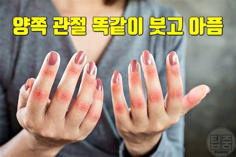 류마티스 관절염 초기 증상 6가지 류마티스관절염 자가진단