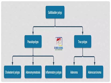 Gallbladder Polyppptx