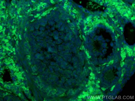 Amh Antibody Cl488 14461 Proteintech