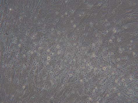 Cell Debris Or Contamination Dots In Bone Marrow Stem Cell Culture