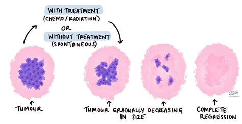 Tumour Regression MyPathologyReport