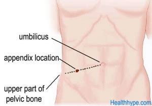 Appendix Pain Location And Surgical Removal Appendectomy Healthhype