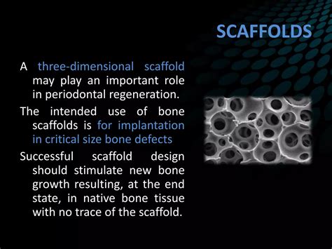Periodontal Regeneration Ppt