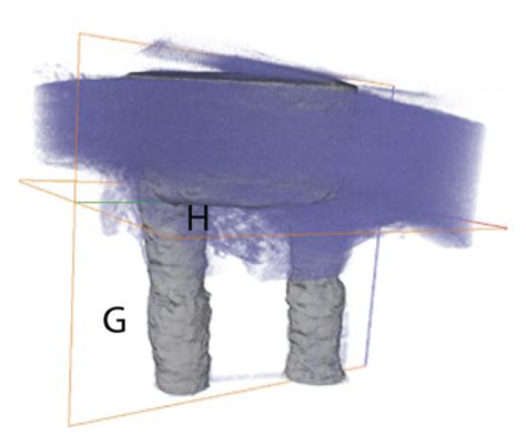 Micro Ct Analysis Following 3 Week Implantation Of Ctrl Left Column Download Scientific