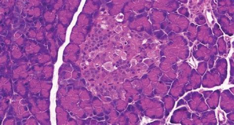 Photomicrographs Of Sections Of The Pancreas Stained By Hande By The End