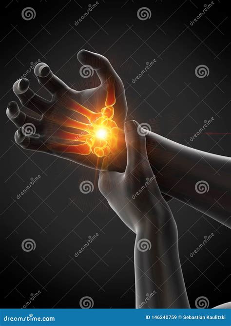 Una Mu Eca Dolorosa Stock De Ilustraci N Ilustraci N De Humano