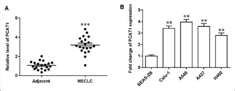 Lncrna Pcat1 Is Upregulated In Human Nsclc Tissues And Cell Lines A