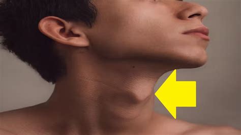 Does Adam S Apple Make Your Voice Deeper YouTube