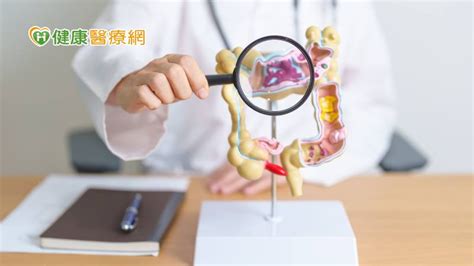 大腸癌篩檢正確步驟曝！ 無血便也要篩？篩陽是痔瘡出血再篩1次就好？