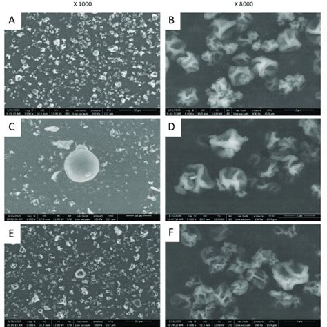 Microparticle Analysis By Sem Observations With A Scanning Electron