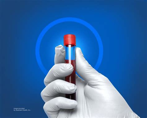 Guardant Health 2023q1营收129亿美元，同比增长34，调高全年营收指引至535 545亿美元 知乎