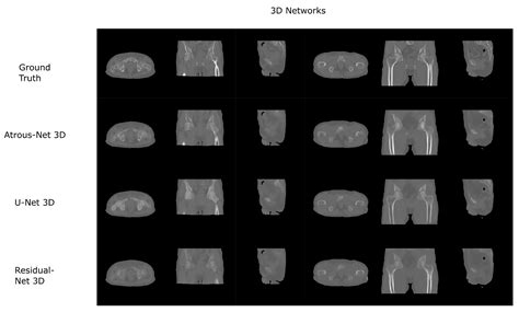 How To Pseudo Ct A Comparative Review Of Deep Convolutional Neural