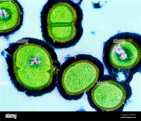 Mrsa Resistant Staphylococcus Bacteria Coloured Transmission Electron
