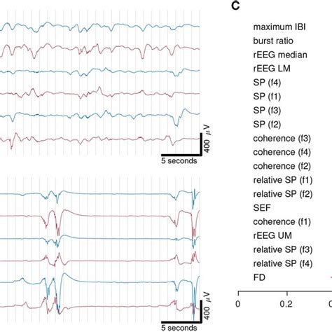 Procedure For Generating Qeeg From Continuous Eeg Download