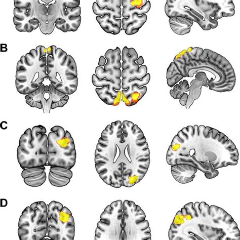 Associations Between Age And Task Based Functional Connectivity A Download Scientific
