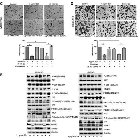 Gsk3b Inhibitors Rescue Bs Imediated Inhibition Of Migration And