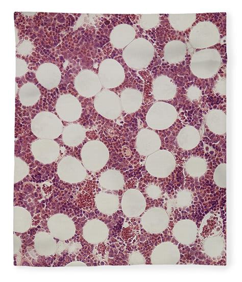 Decalcified Bone Cross Section Lm Fleece Blanket By Science Stock