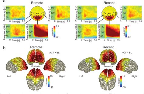 Figure 3 From The Neocortical Network Representing Associative Memory Reorganizes With Time In A