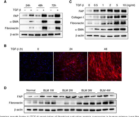 Figure 1 From Comprehensive Analysis Of Fibroblast Activation Protein Expression In Interstitial
