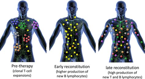 Clinical Relevance Of Thymic And Bone Marrow Outputs In Multiple