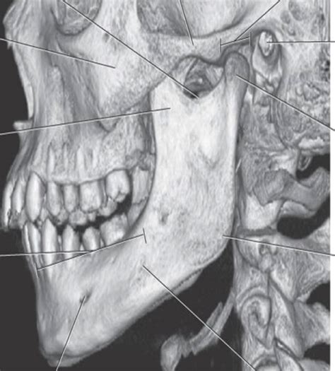 Csa Orbits Tmj Sinus Diagram Quizlet
