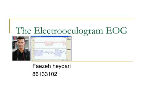 Ppt The Electrooculogram Eog Powerpoint Presentation Free Download