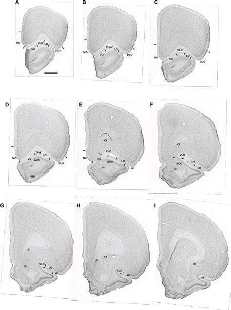 Figure 8 From Projections Of The Posterior Parietal Cortex To The Orbitofrontal Cortex In The