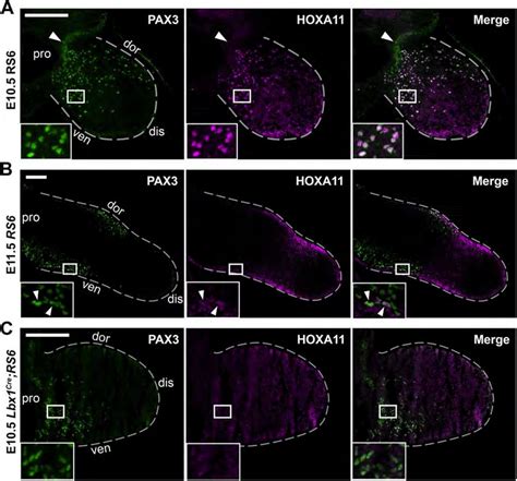 Hox Proteins In Mpcs Relies On Bmp Signaling Co Immunohistochemistry