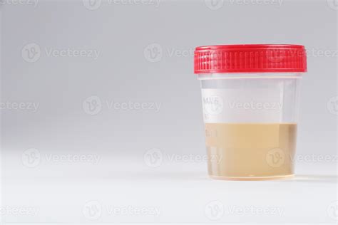 Plastic Container With Yellow Urine Analysis For Detecting Diseases