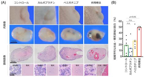 卵巣がんのプラチナ抵抗性に関与する特殊な細胞群を同定 リソウ