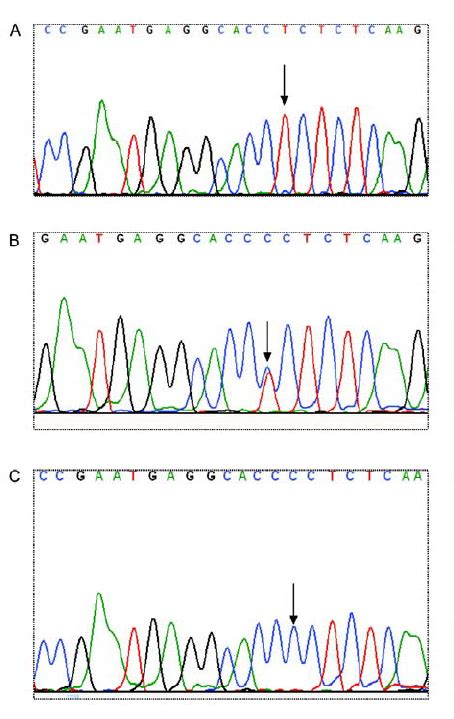 DNA Sequence In Exon Of AR Gene Exon Gene Showing Download Scientific Diagram