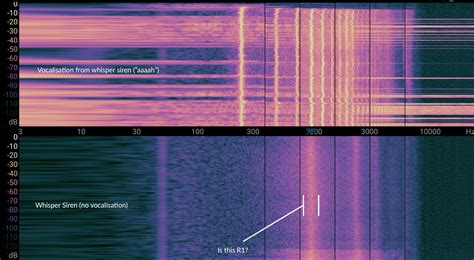 How Do You Monitor R1 Objectively Using A Spectogram Rtransvoice