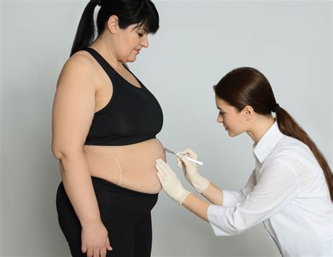 Long Term Pharmaceutical Intervention For Obesity