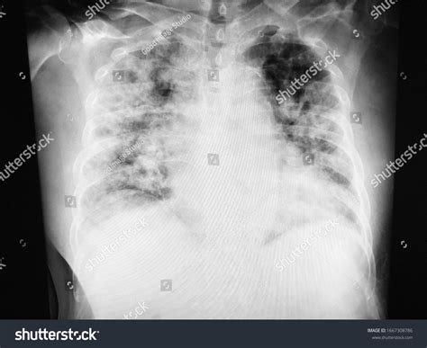 4 Pjp 이미지 스톡 사진 및 벡터 Shutterstock