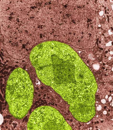 Nosema Apis Tem Stock Image C028 2670 Science Photo Library