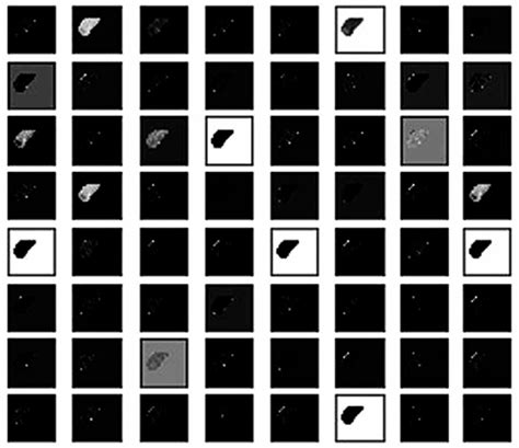 Non Invasive Multi Channel Deep Learning Convolutional Neural Networks For Localization And