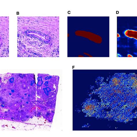 results of patch level segmentation a a sample raw patch b