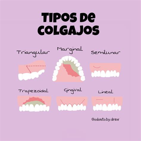 Tipos De Colgajos Odontolog A Odontologia Pediatrica Exodoncia