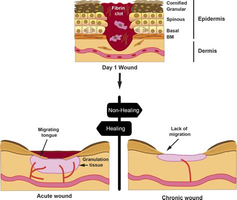 Frontiers Chronic Wound Healing By Amniotic Membrane Tgf β And Egf