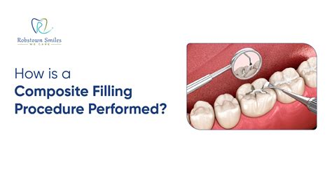 How Is A Composite Filling Procedure Performed Robstown Smiles