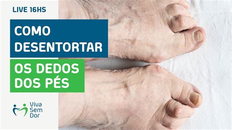Como Desentortar Os Dedos Dos Pés Que Têm Artrose Youtube