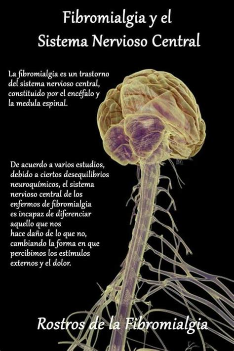 Pin De Antonia Gamero Borrego En Fibromialgia Fibromialgia Sistema